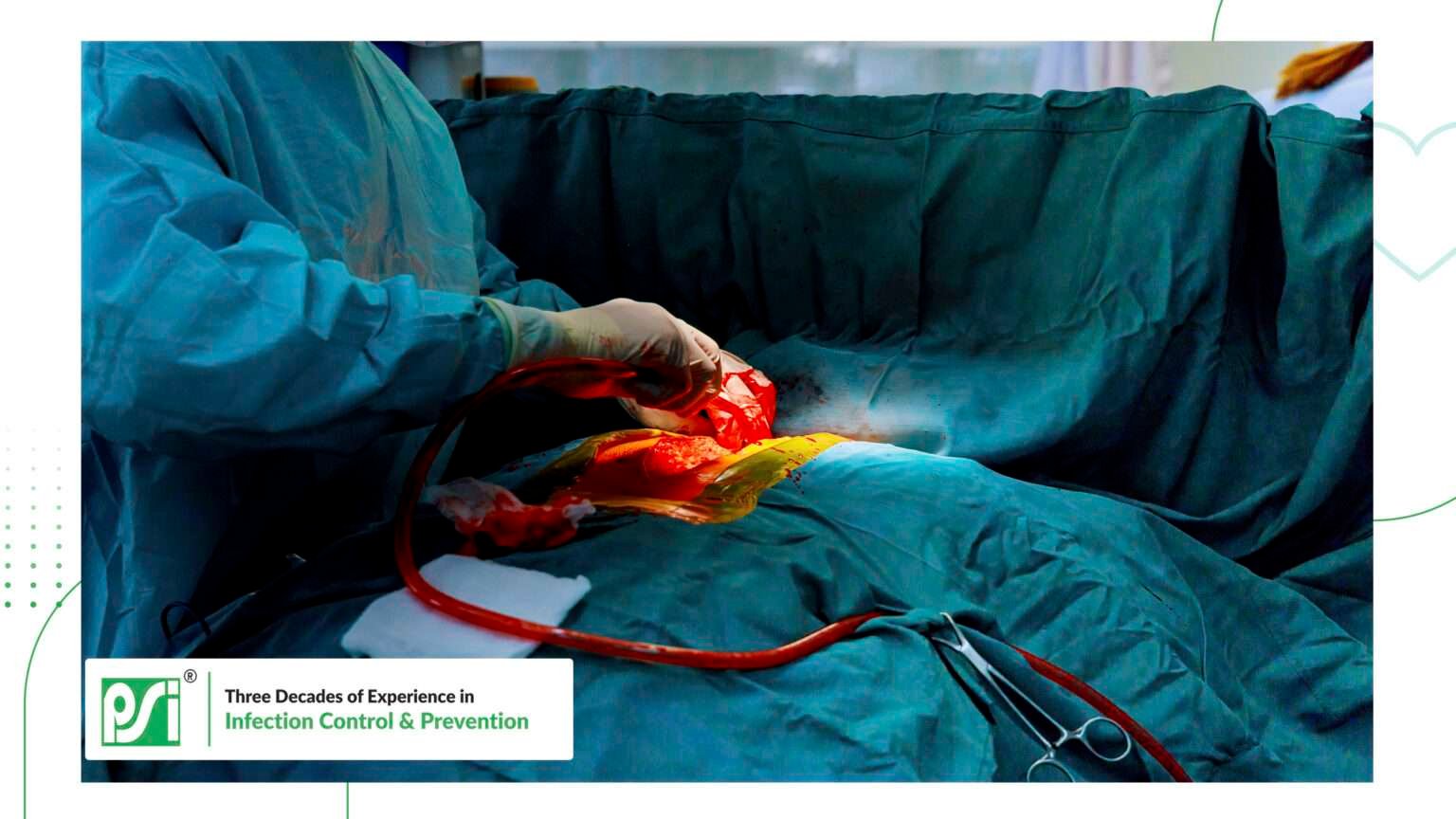 The Future of Cardiovascular Drapes